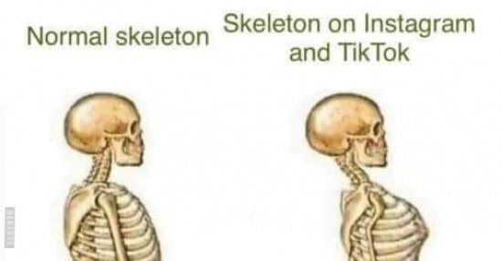 Normal Skeleton. Skeleton on Instagram and TikTok. - DEBESTE.de